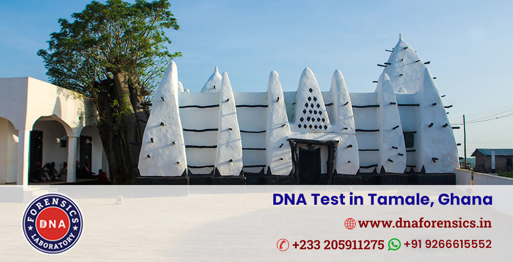DNA Test in Tamale | DNA Center in Tamale with Accurate Results