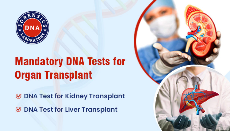 Accurate and Accredited Organ Transplant DNA Test
